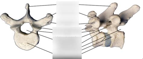 Vertebrae Diagram Quizlet