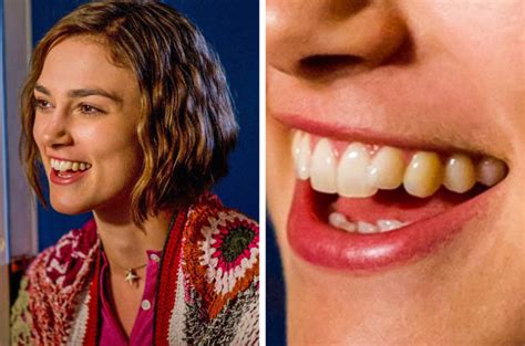 Yes These Celebs Are Imperfect But Who Cares 10 Pics