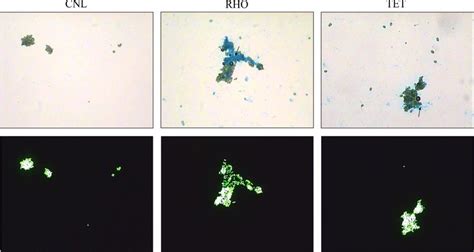 Aggregates Of 4 3 µm Fluorescent Microsphere Settled At The Bottom Of