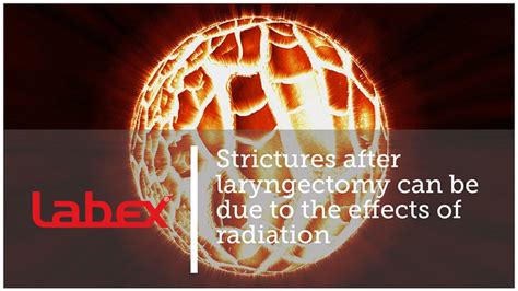 Flickriver Photos From Electrolarynx