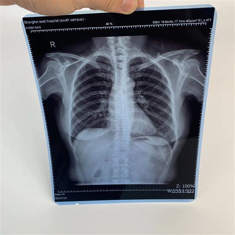 Mp5670 Medical Imaging X Ray Inkjet Film Printer Inkjet Film Printer