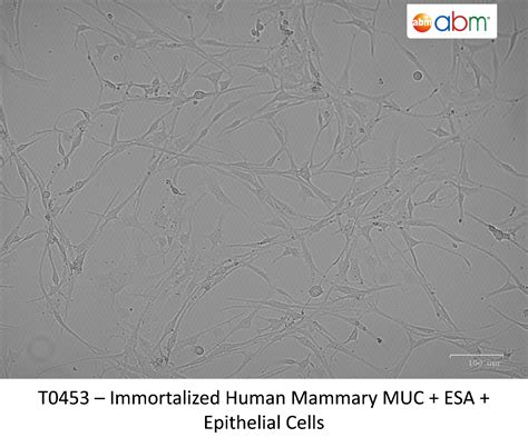 Immortalized Human Mammary Muc Esa Epithelial Cells Applied Biological Materials Inc
