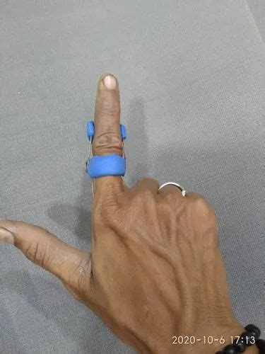 Blue Capener Splint For Hospital Size Medium At ₹ 250 Piece In Navi