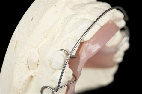 Upper Orthodontic Appliance On Plates Cast Science Museum Group