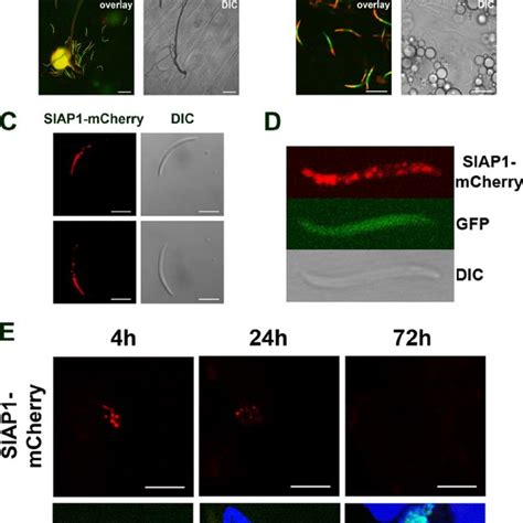 Siap 1 Ϫ Sporozoites Fail To Colonize The Mosquito Salivary Glands