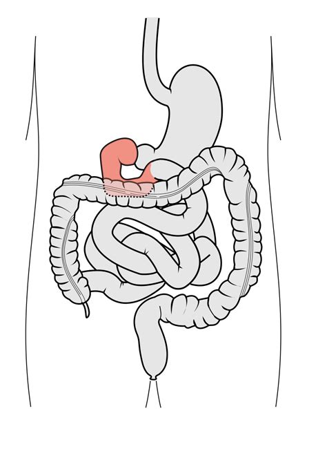Duodenum Wiktionary The Free Dictionary