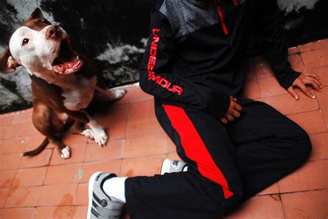 Nuevo Ataque De Un Perro Pitbull A Un Niño En Santander