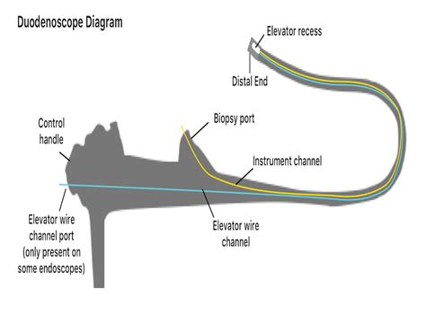 Diagnostic Gi Procedures Landmark Hospital