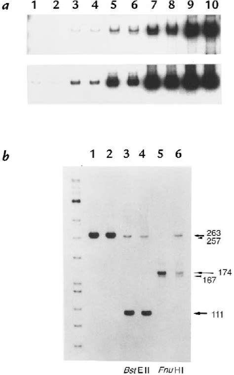 Figure 3 From A Mutation In The Insulin 2 Gene Induces Diabetes With