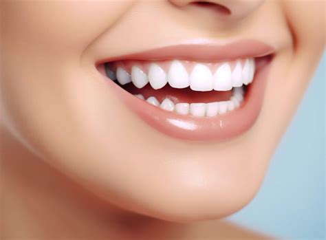 Top 4 Aesthetic Considerations For The Perfect Smile Aestheticpoems