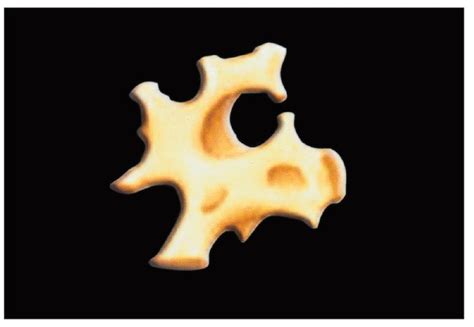 2 Review Of Bone Grafting Materials Pocket Dentistry