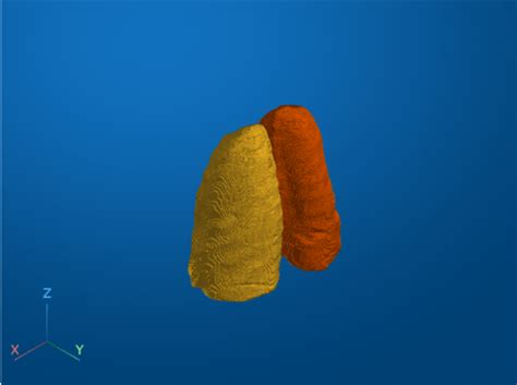 Segment Lungs From CT Scan Using Pretrained Neural Network
