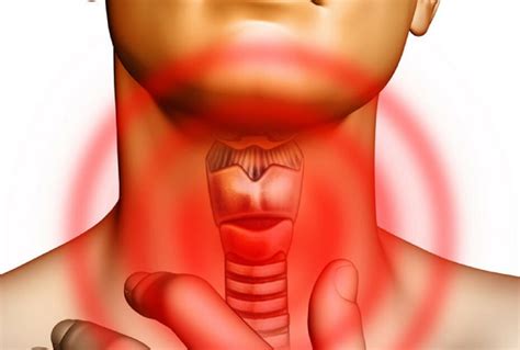 Hyperthyroidism Symptoms Causes Prevention And Treatment