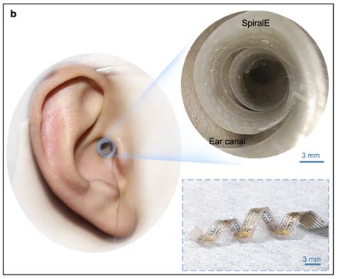 In Ear Bioelectronic May Replace Leading Brain Computer Implants
