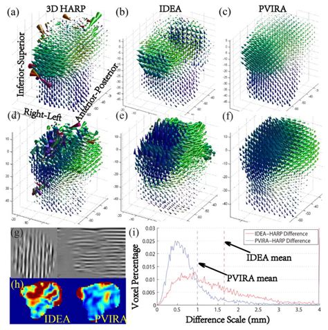 Phase Vector Incompressible Registration Algorithm For Motion Estimation From Tagged Magnetic