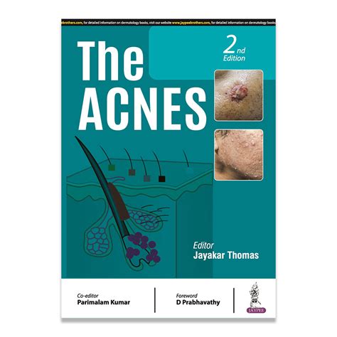 Buy The Acnes