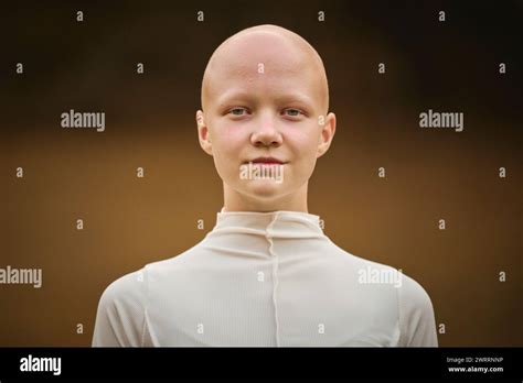 Portrait Of Young Hairless Girl With Alopecia In White Cloth On Autumn