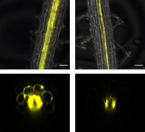 iron influences plant immunity and may promote resiliency against