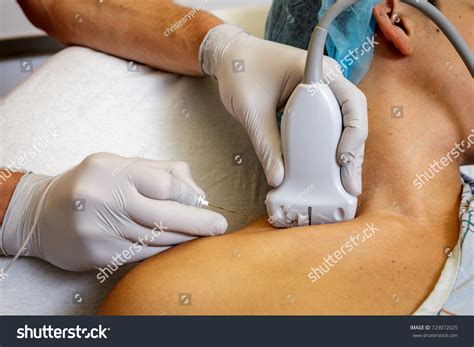 1 034 Nerve Block Images Stock Photos Vectors Shutterstock