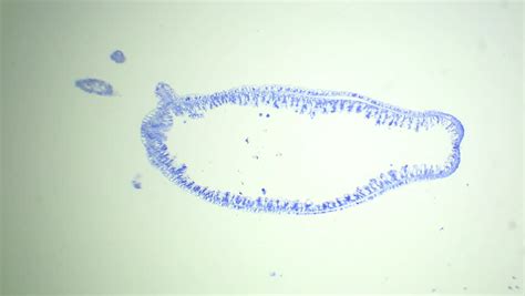 Longitudinal Section Hydra Under Microscope S Stock Footage Video 100
