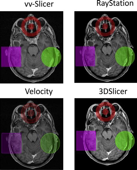 Simple Python Module For Conversions Between Dicom Images And Radiation