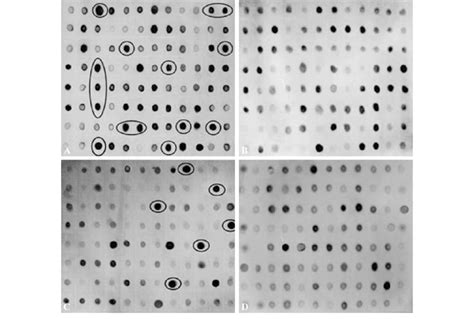 Differential Screening Of Cdna Clones From The Ssh Libraries To