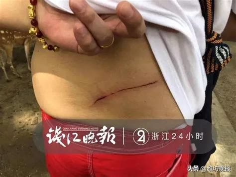 太兇了中國遊客奈良餵鹿受襲送醫腰部傷口長20厘米鮮血直流 每日頭條