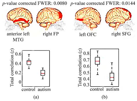 Link Level Functional Connectivity Neuroalterations In Autism Spectrum Disorder A Developmental