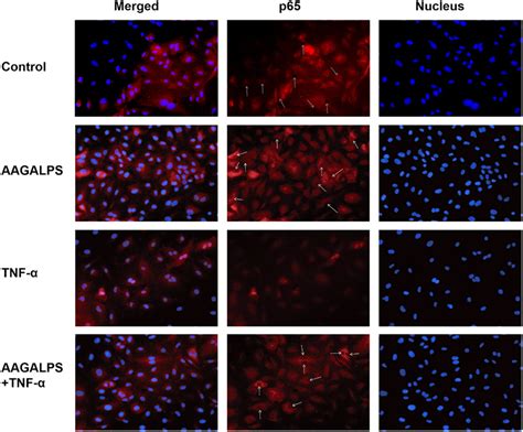 Effects Of Aagalps On Tnf‐α‐induced P65 Translocation Confluent Huvecs