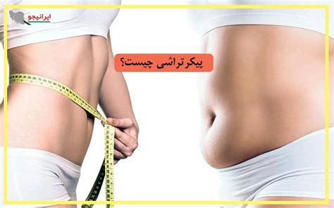 پیکر تراشی چیست؟ انواع روشهای پیکرتراشی، مزایا و عوارض آن