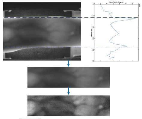 4 Flow Diagram Of Pre Processing Top The Original Vein Image And