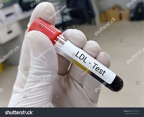 12 301 Cholesterol Treatment Images Stock Photos Vectors Shutterstock