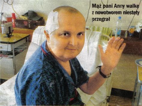 Glejak Pl Z O Liwy Nowotw R M Zgu Objawy I Leczenie Zobacz W Tek
