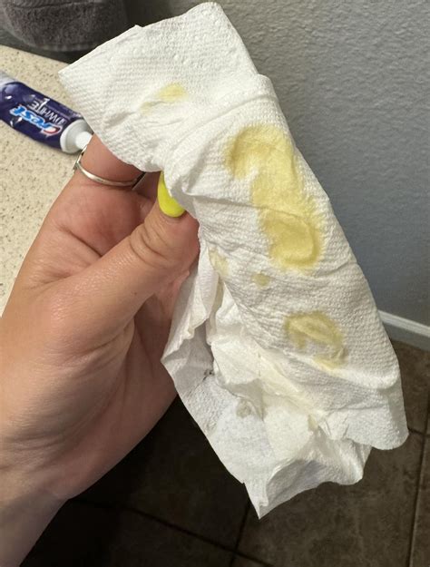 Does This Sound Like A Csf Leak Rcsfleaks