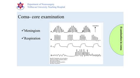 Coma Vegetative And Locked In Syndrome Pptx
