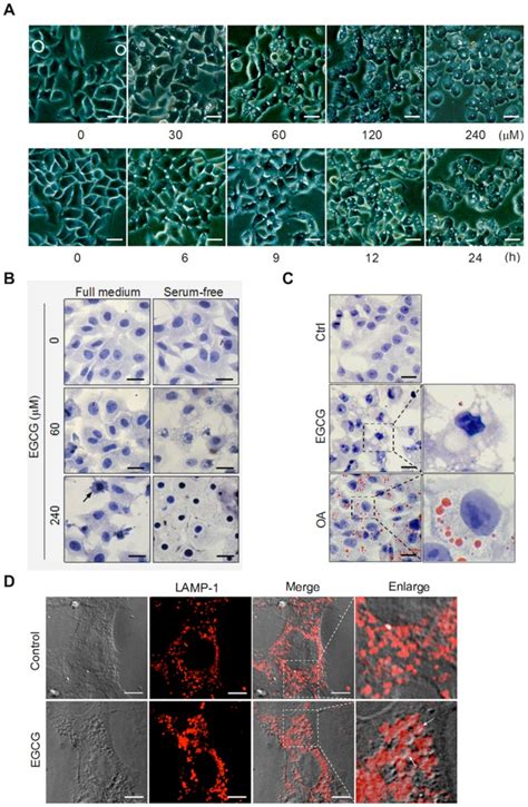 A Morphological Alterations Of EGCG Treated Cells In Serum Free