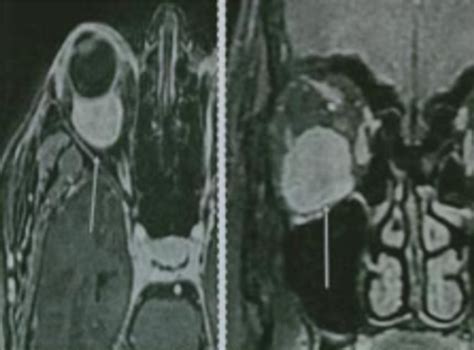 Ninegaze Showing Elevation Restriction Download Scientific Diagram