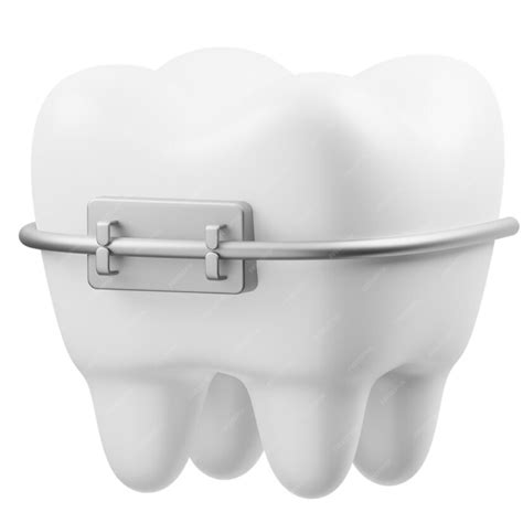 Premium Photo Dental Braces On Teeth