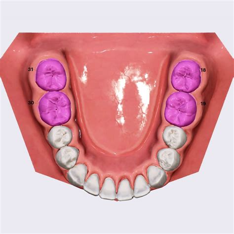 Mandibular Molar Diagram 6 Times The Natural Size Anatomic Profile