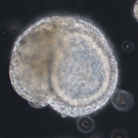 Cardiac Organoid Lambda Biologics