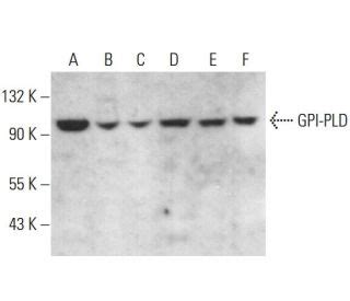 GPI PLD抗体 D 10 SCBT Santa Cruz Biotechnology
