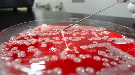 Klebsiella The Catch Of Type Ned Rivm