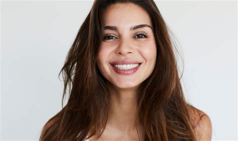 Smile Makeover Elevate Confidence With Dental Veneers