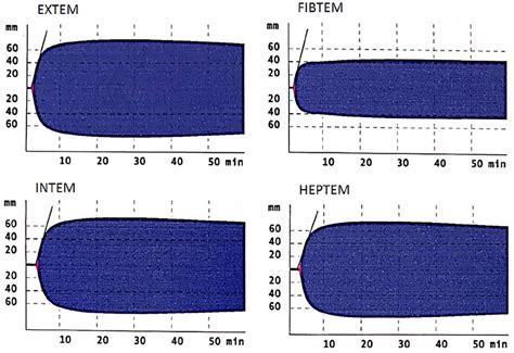 Thromboelastometry Showing Hypercoagulable State Download Scientific