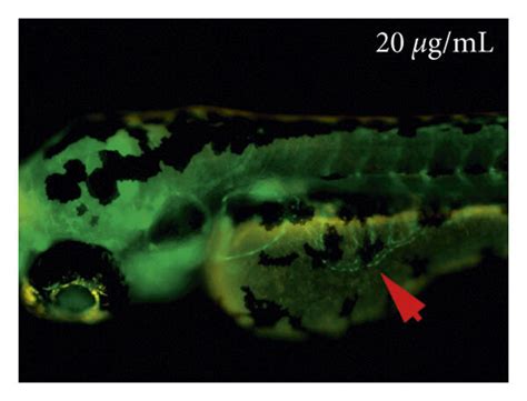 Effect Of Ecb On Siv And Isv Angiogenesis In Zebrafish Embryos