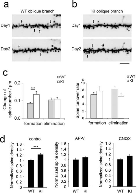 Spine Formation And Elimination In Ca1 Pyramidal Neurons In Camkiiα Ki