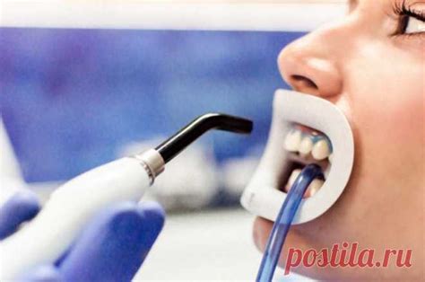 Щетки недостаточно Эксперт рассказал как правильно чистить зубы Вс Новости Постила