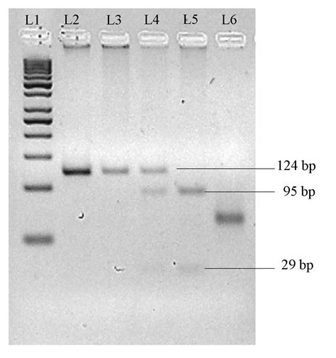 Association Of NOD1 CXCL16 STAT6 And TLR4 Gene Polymorphisms With