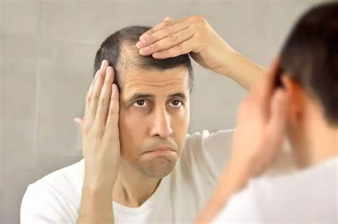 Cómo Poner Remedio a las Entradas y Recuperar el Pelo Perdido Vera Clinic