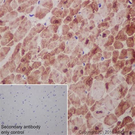 封固剂with Dapi Aqueous，fluoroshield Abcam中文官网